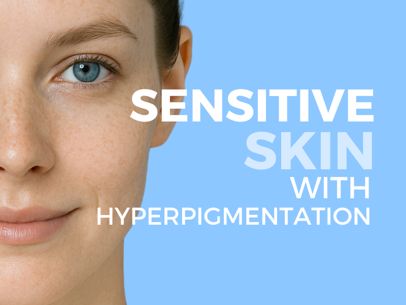 Dermedic Melumin – depigmenting and anti-aging line for discoloration ...