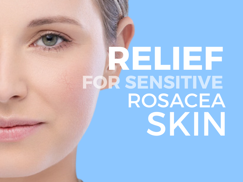 Dermedic Redness Calm – soothing for skin with rosacea and redness ...